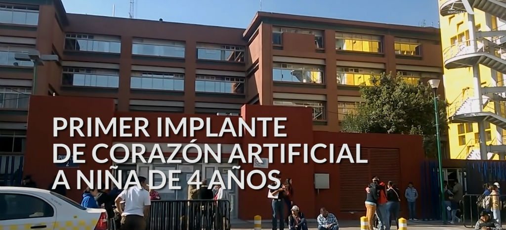 Implantan el primer corazón artificial a niña de 4 años en México ...