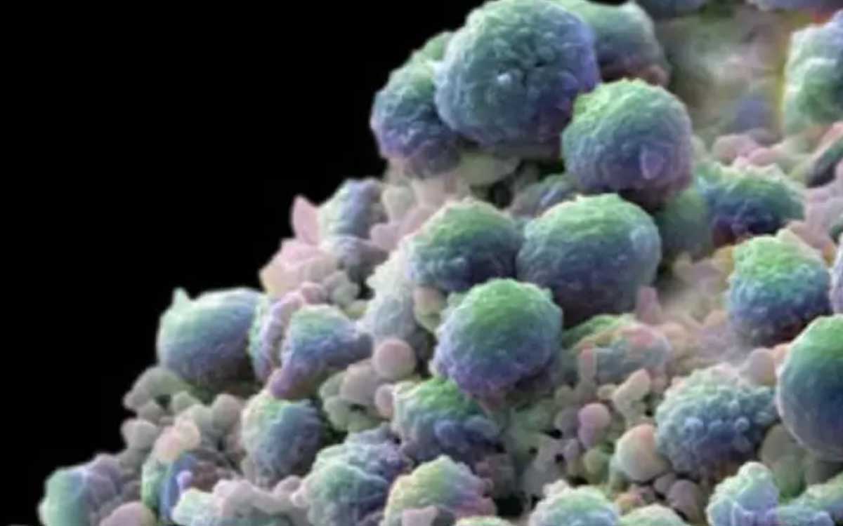 Fármaco contra el cáncer logra reducir tumores en primer ensayo clínico ...