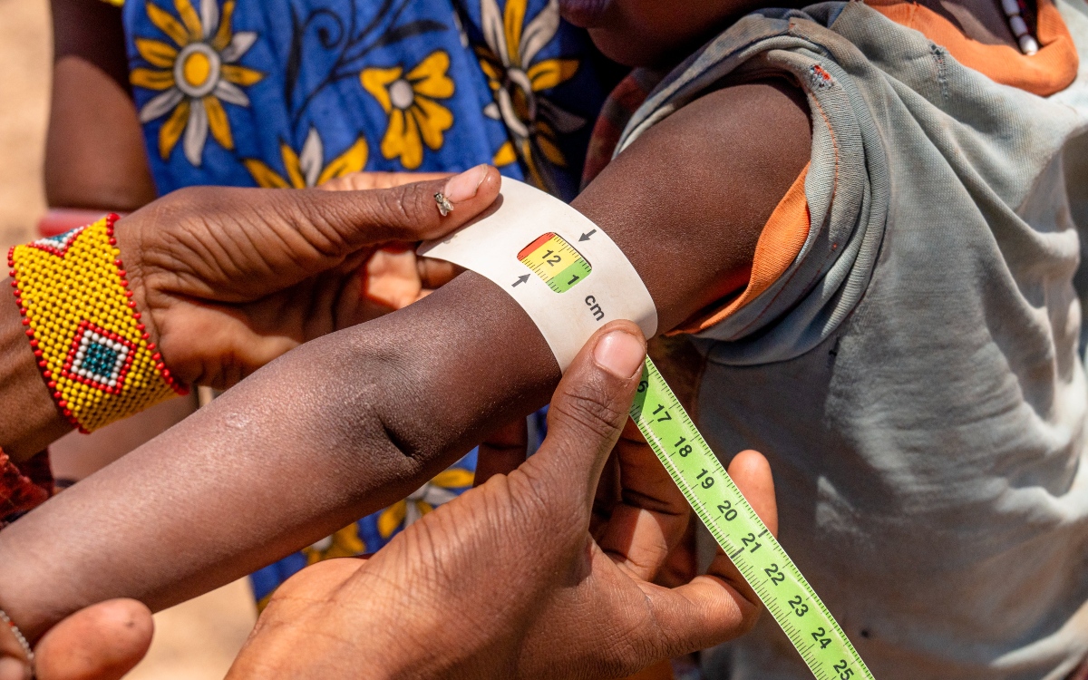 30 millones de niños en el mundo sufren desnutrición: ONU | Aristegui ...