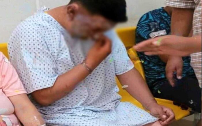 Permanecerá en hospital de Axapusco el piloto del globo incendiado en ...