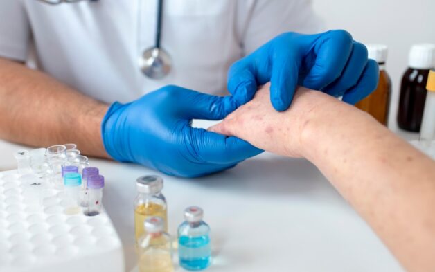 ¿Cómo se contagia la lepra?, enfermedad prioritaria en 12 municipios de ...