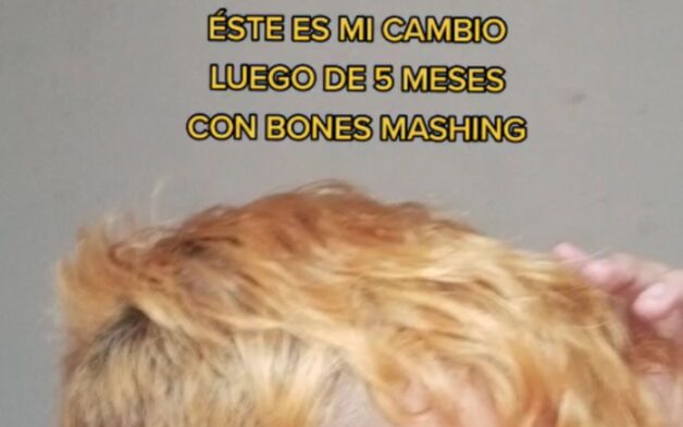 'Bone smashing', la peligrosa tendencia de Tiktok que promete belleza ...